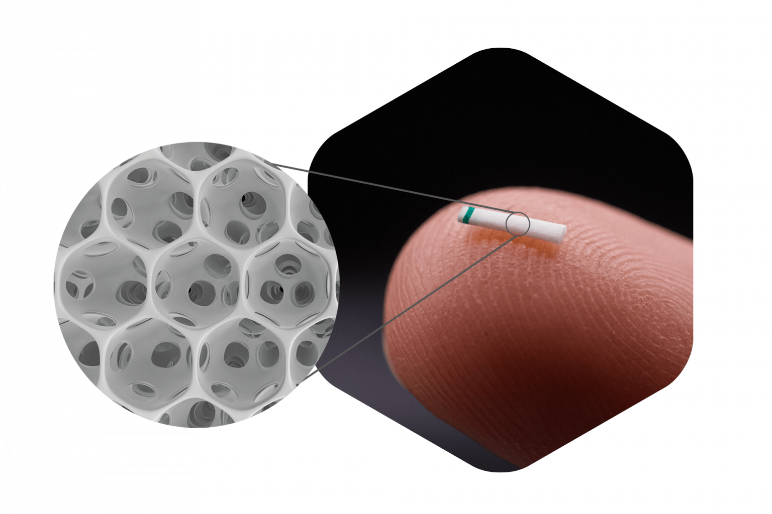 Multimedia gallery - iSTAR Medical