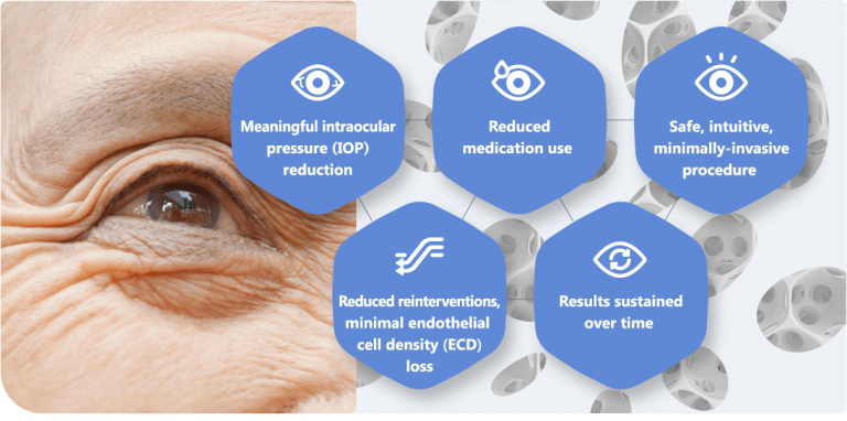 MINIject - iSTAR Medical